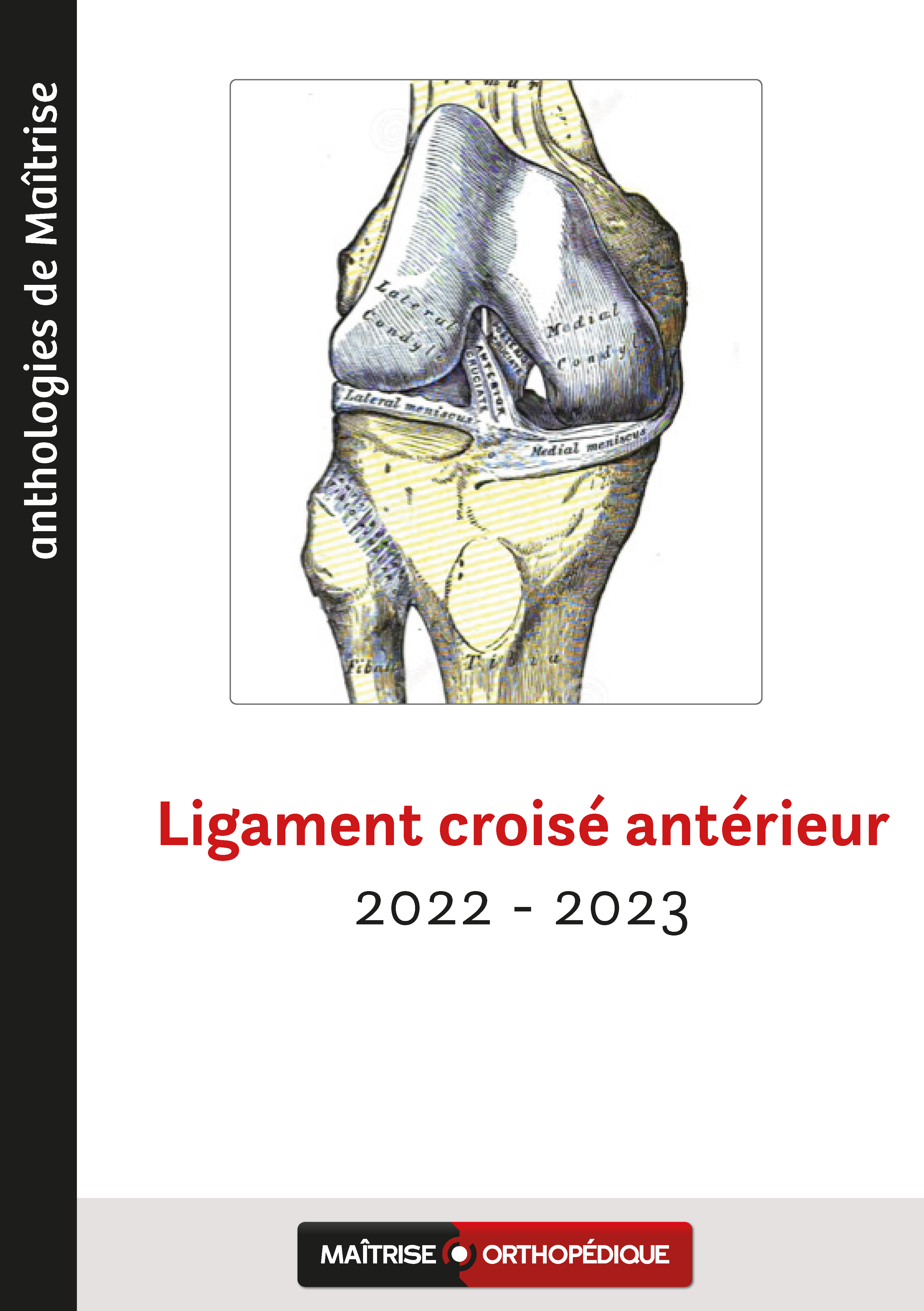 Le ligament croisé antérieur T3 – Maîtrise Orthopédique