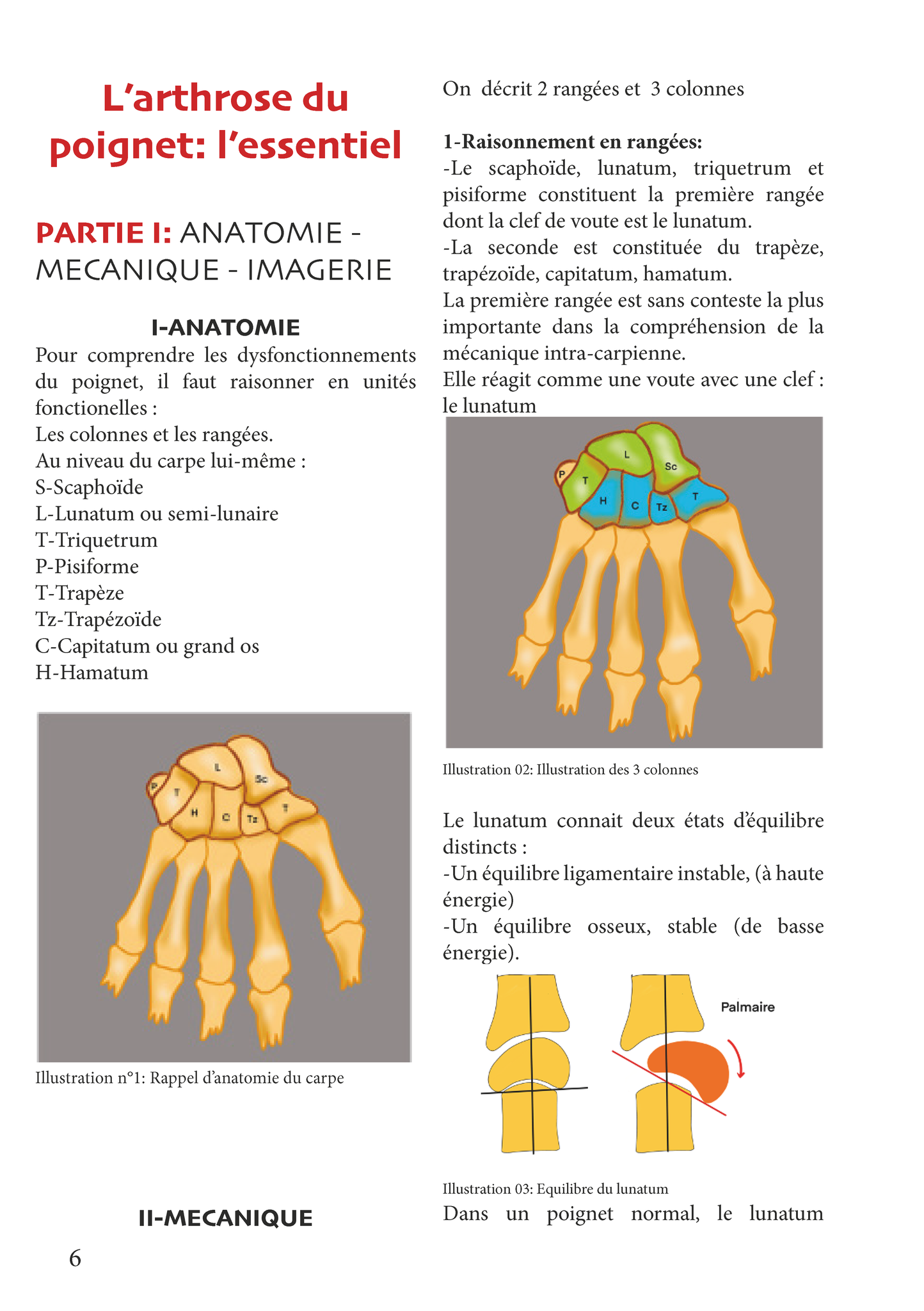 Arthrose du poignet – Maîtrise Orthopédique